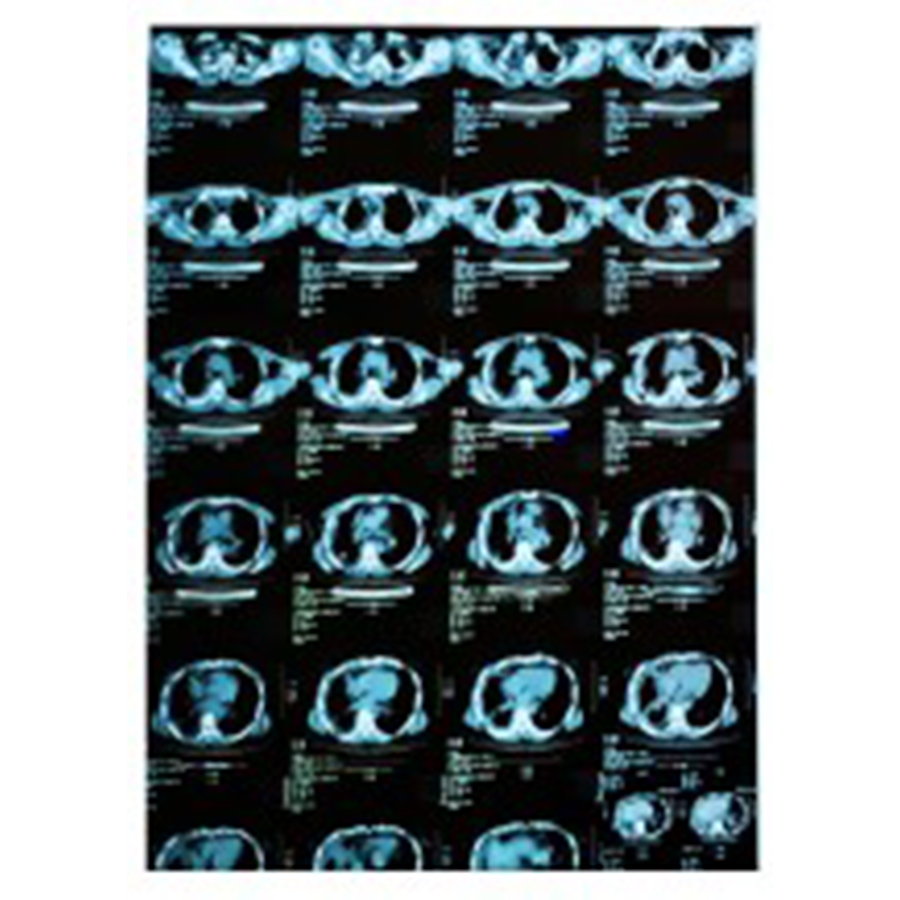 Pixel Xray Dry Film - Macromed Philippines